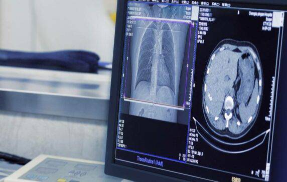 12 Startups Bringing Artificial Intelligence To Cancer Diagnostics And ...