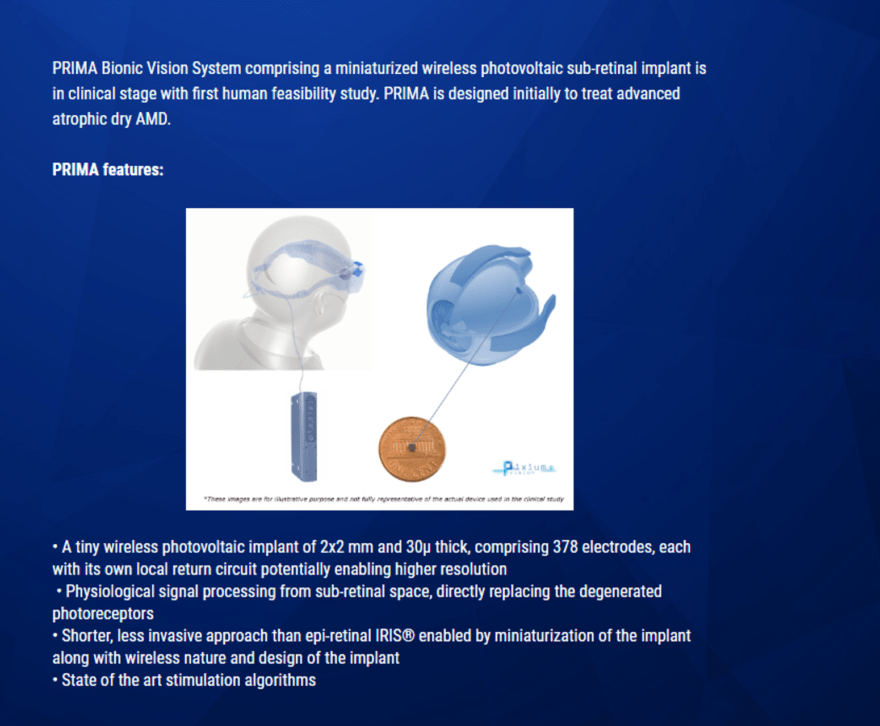 The Body Series: Disrupting Eye Healthcare - CB Insights Research