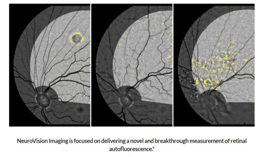 The Body Series: Disrupting Eye Healthcare - CB Insights Research