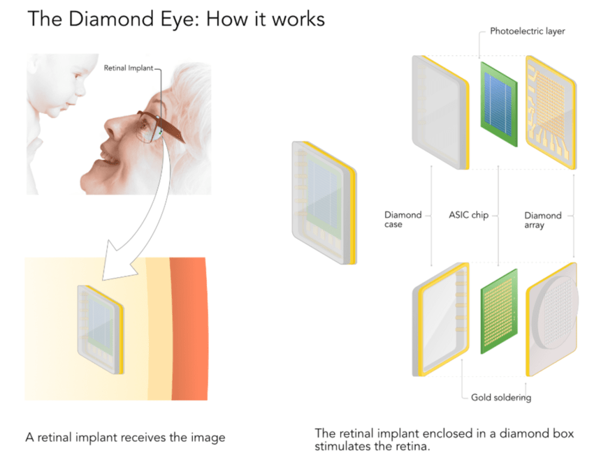 The Body Series: Disrupting Eye Healthcare - CB Insights Research